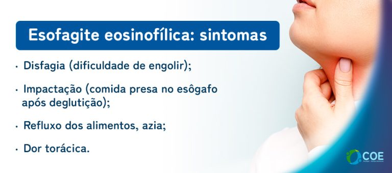 Esofagite eosinofílica: o que é, sintomas e tratamento – COE