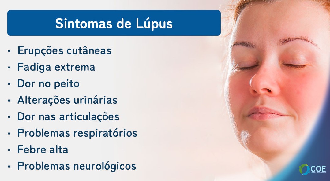 Lúpus: sintomas que exigem ajuda médica – COE