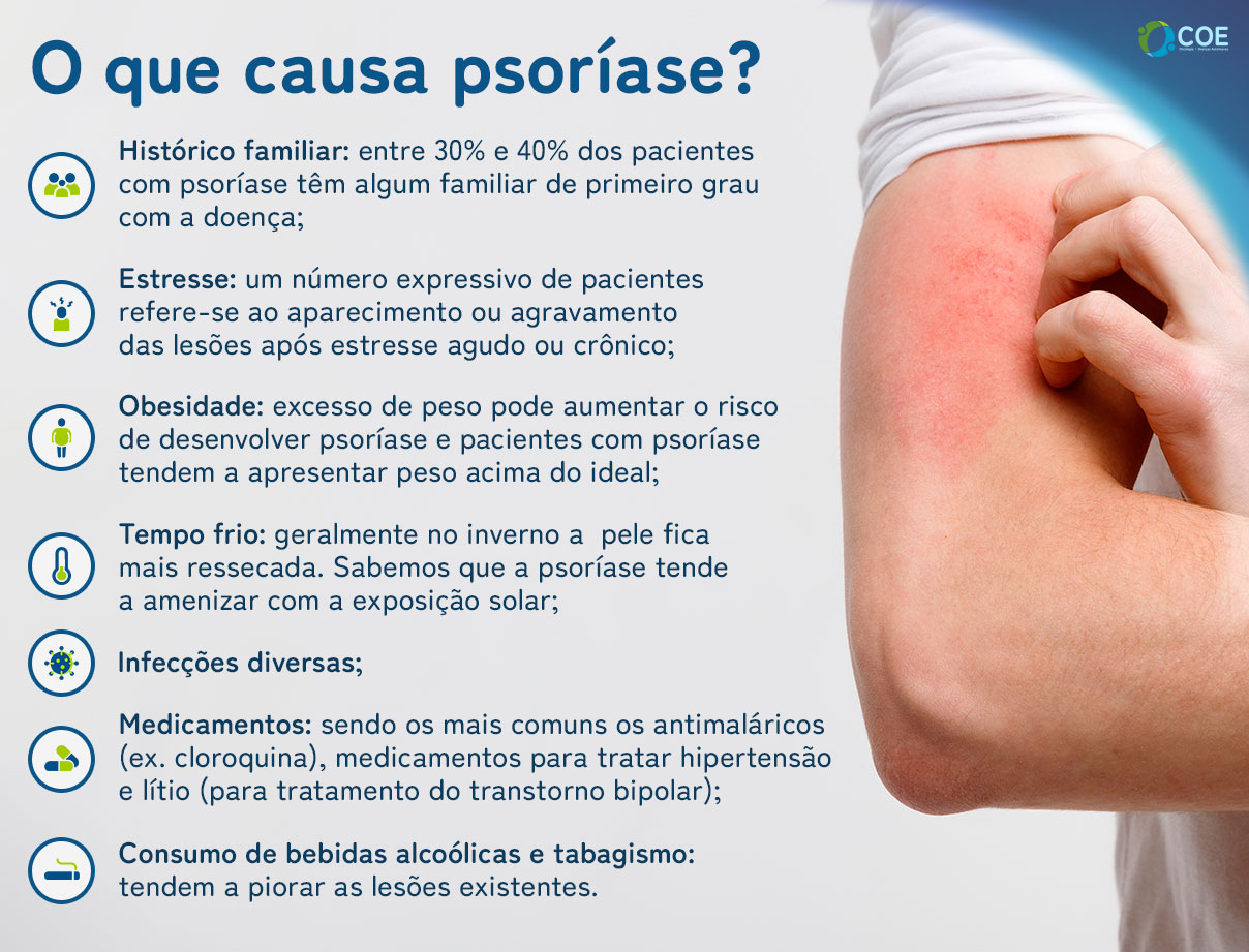 Psoríase: 7 tratamentos para aliviar os sintomas – COE
